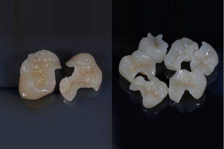 Digital Dental Laboratory in Dubai - Qualident Lab